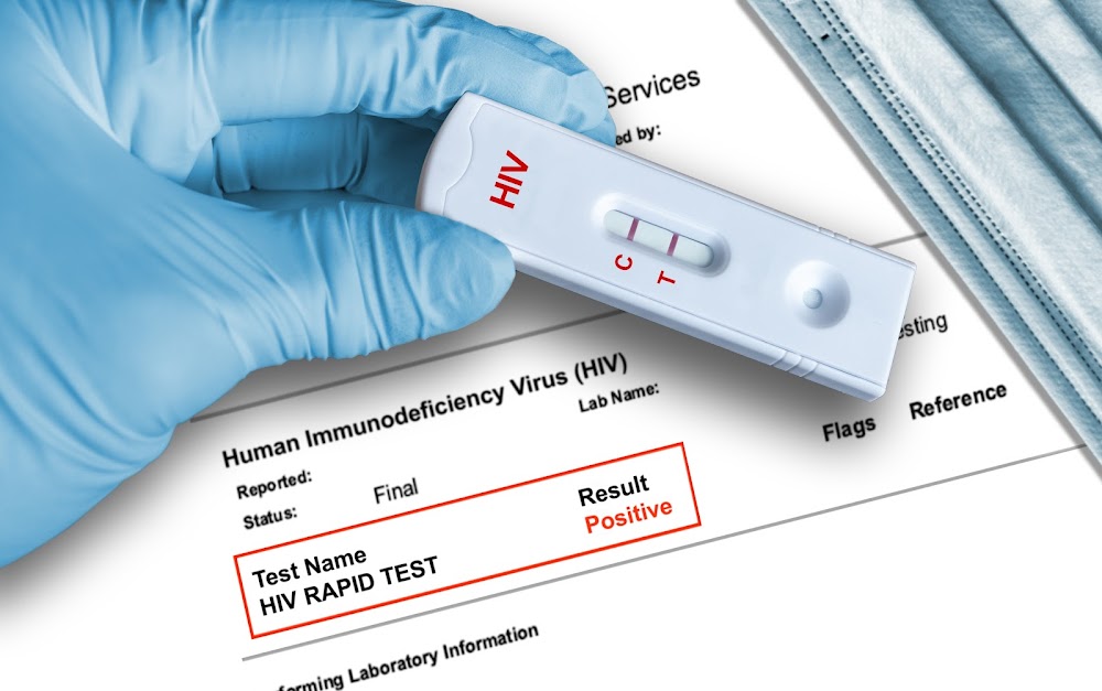 NTV Kenya: HIV patient testing falls in South Africa after US aid cuts ...