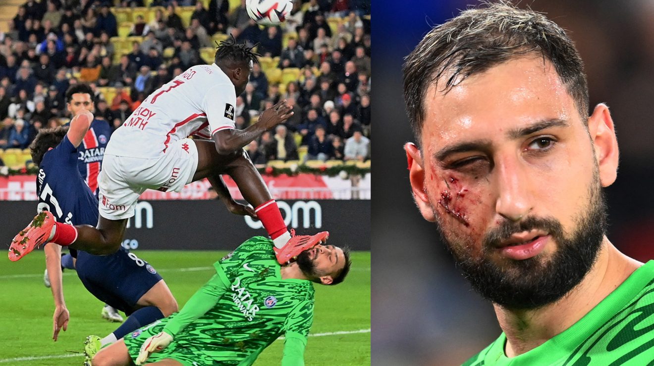 NTV Kenya: PSG keeper Donnarumma suffers facial injury during match