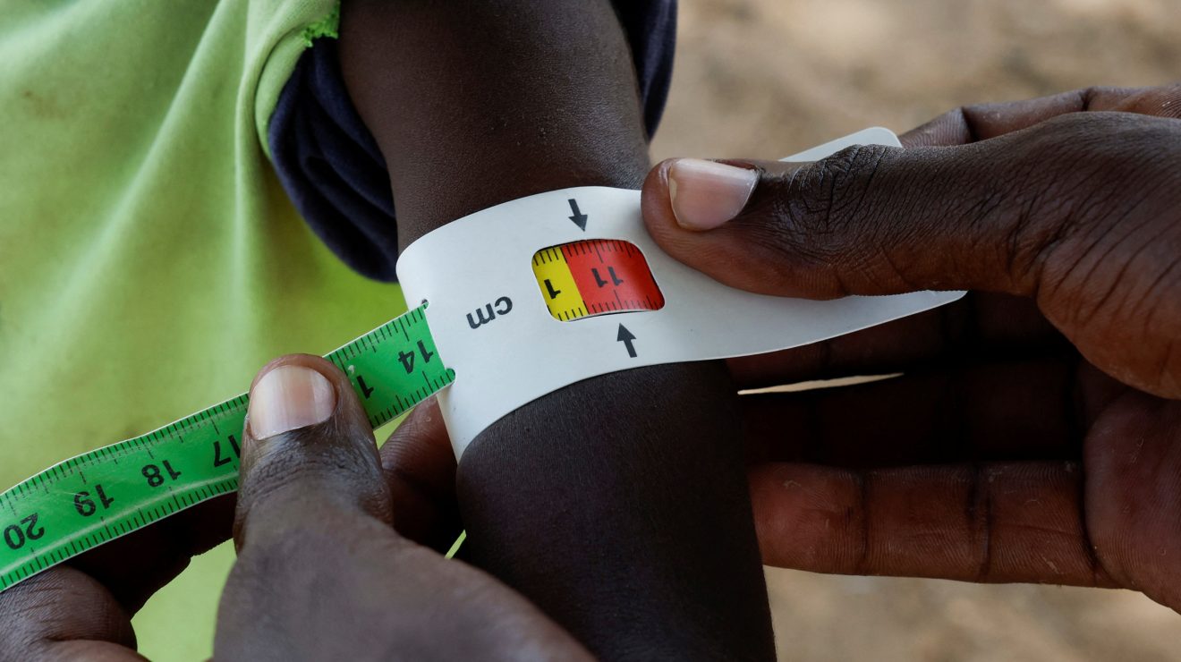 NTV Kenya: US aid cuts disrupt life-saving treatment for starving ...